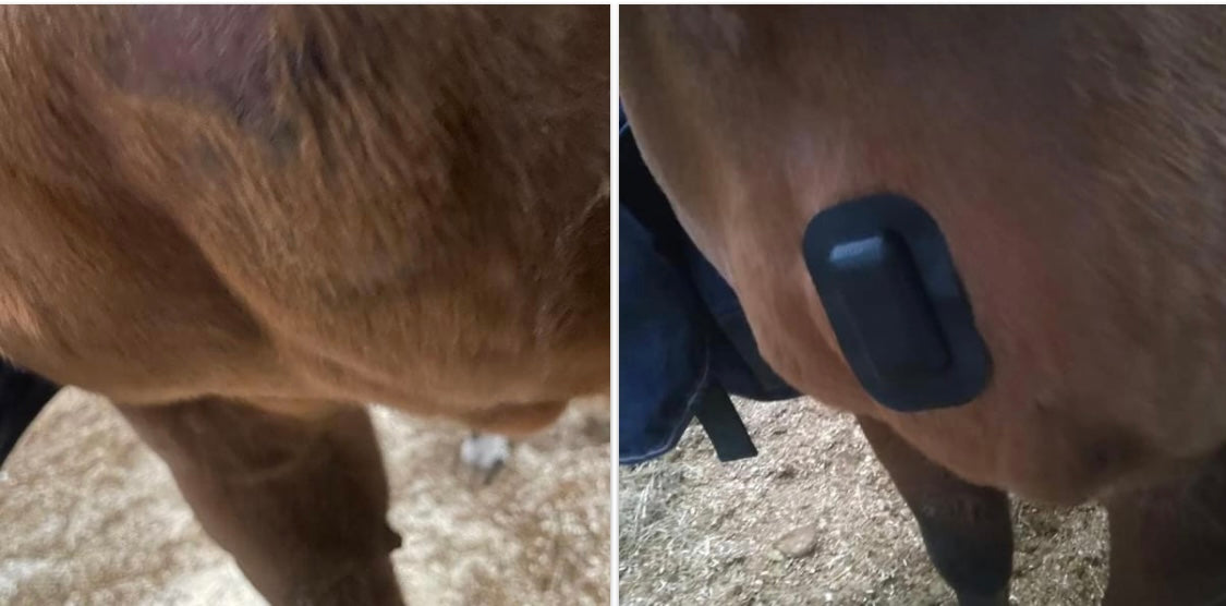 Rheva Wound Protection Plasters - Medical Band -Aid 4-pack -Kombo – CC ...